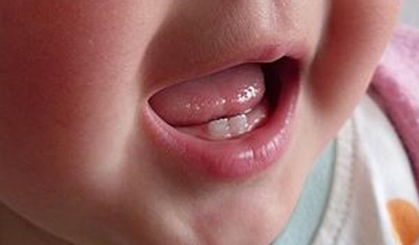 Natal Teeth - Kids Discover