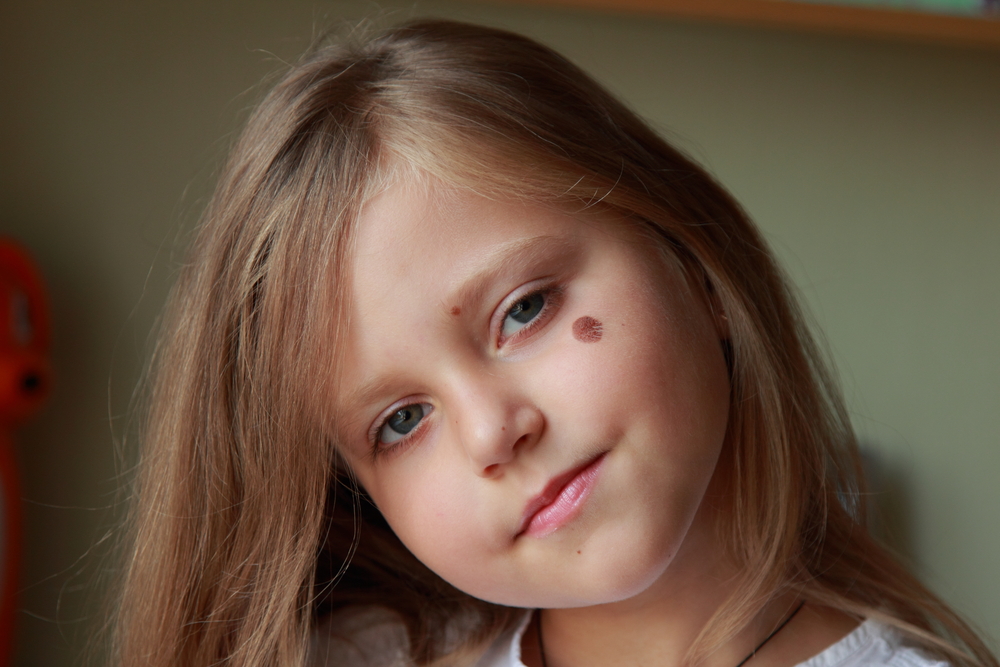 Birthmarks - Kids Discover